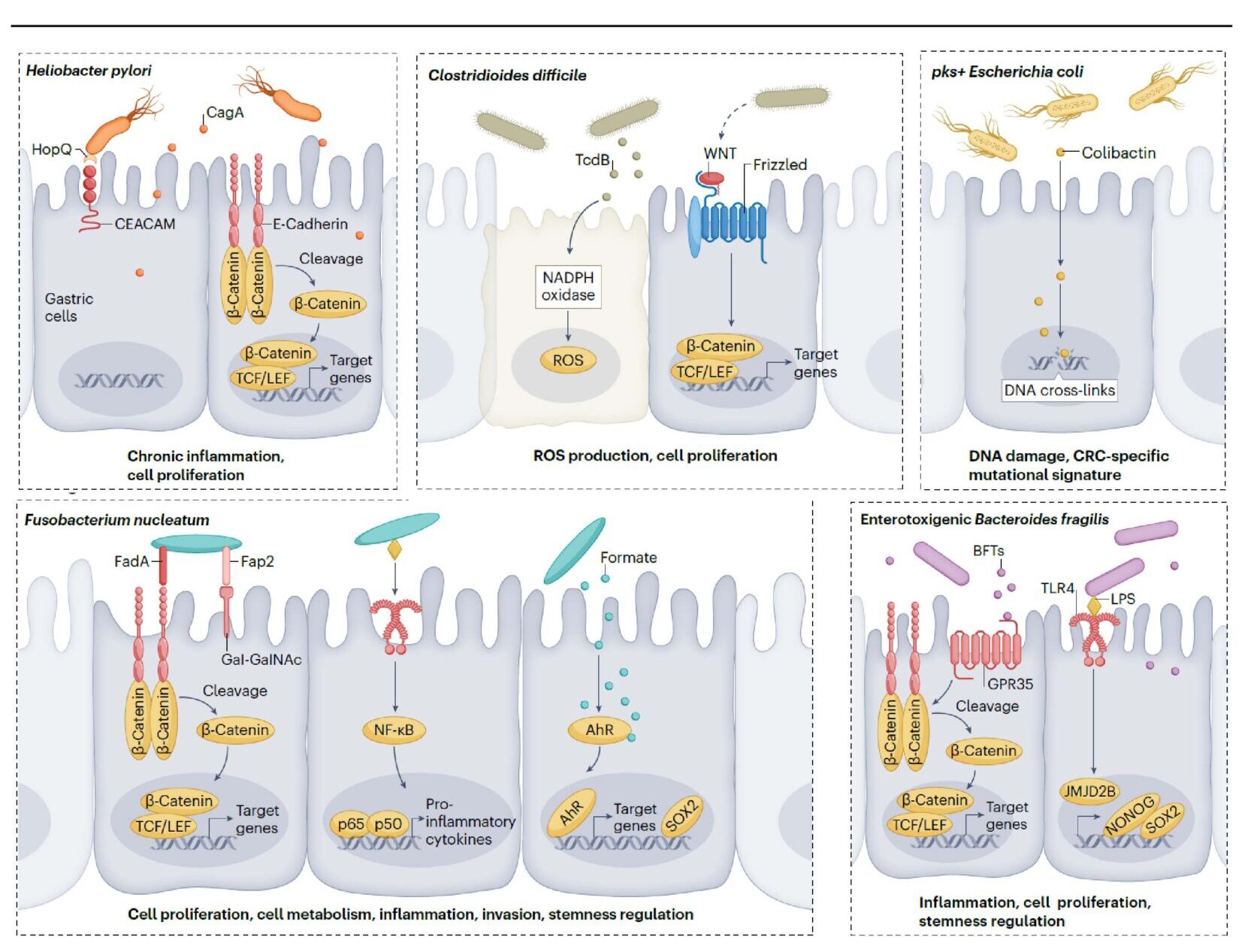 the hidden role of 5 pathogenic gut bacteria in cancer